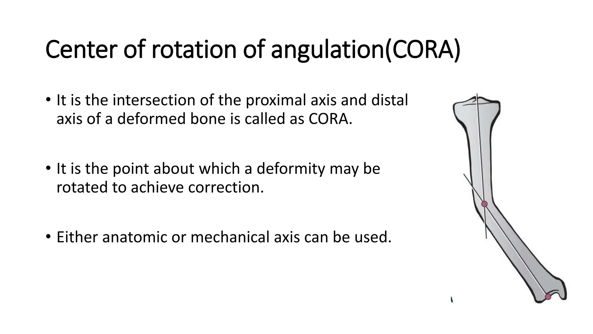HIGH TIBIAL OSTEOTOMY AROUND THE KNEE.pptx