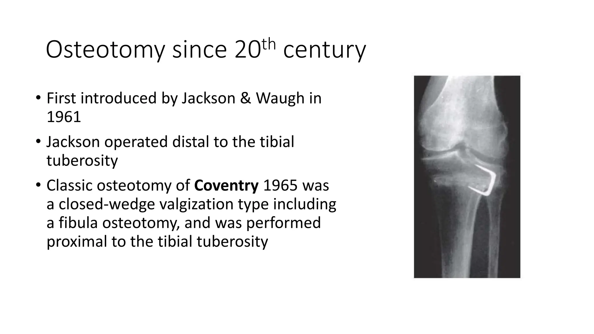 HIGH TIBIAL OSTEOTOMY AROUND THE KNEE.pptx