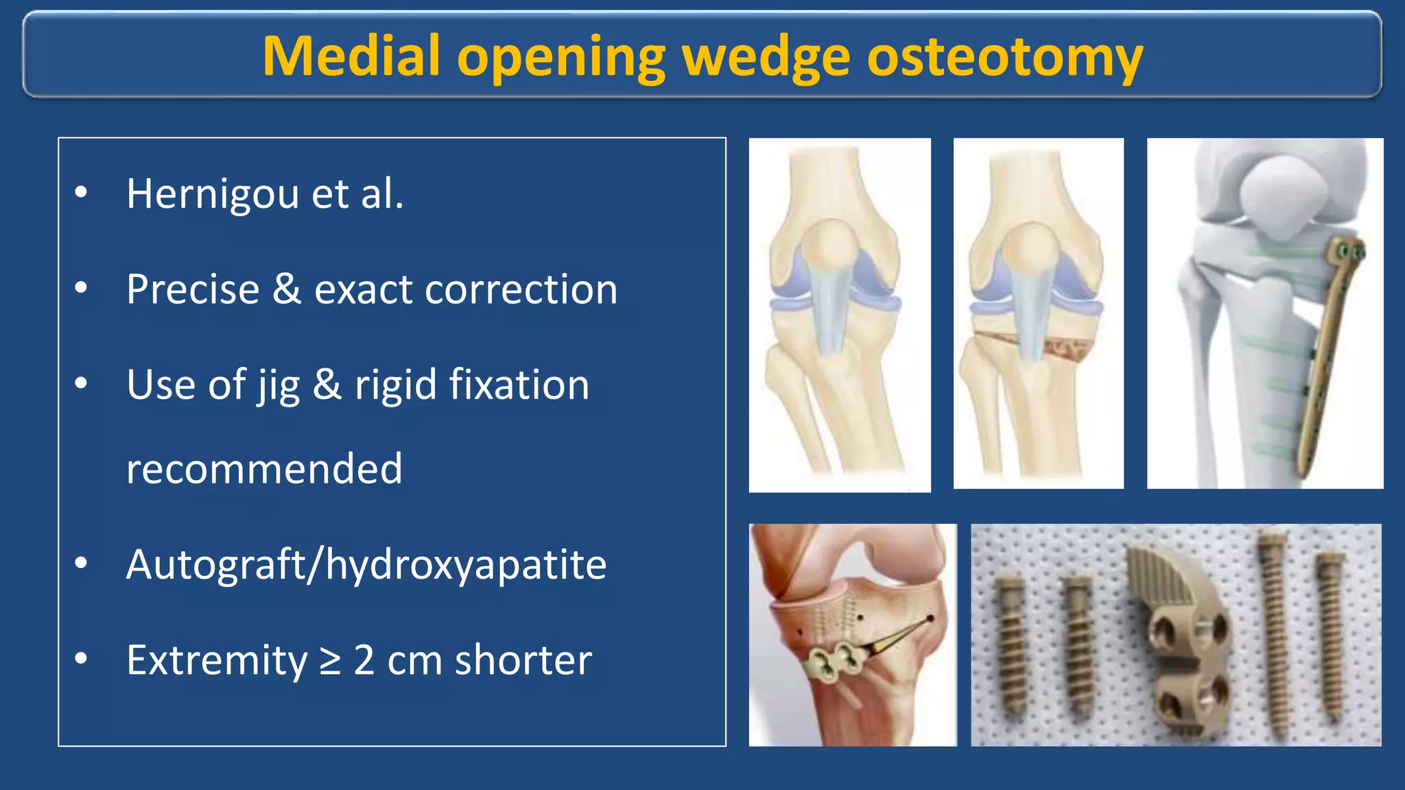 High tibial osteotomy | PPTX