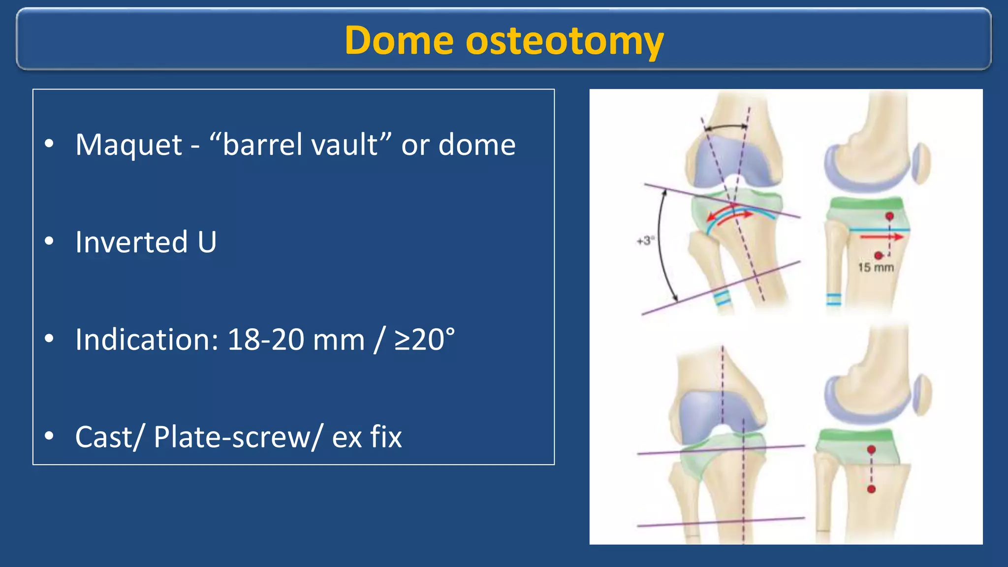 High tibial osteotomy | PPTX