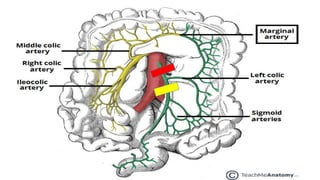 High tie vs low tie | PPTX