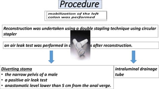 High tie vs low tie | PPTX