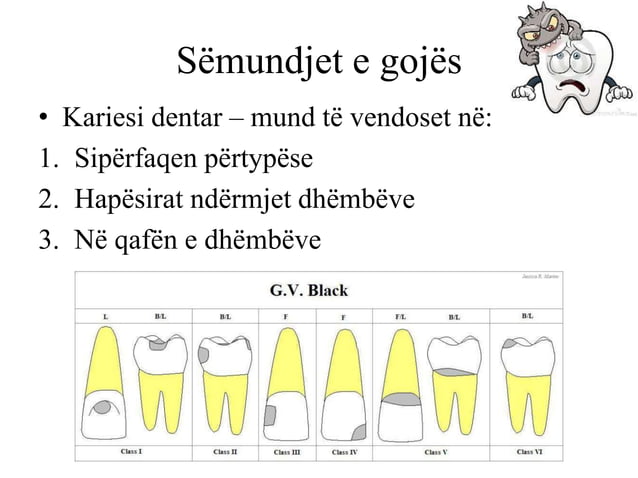 Higjiena e Gojes | PPTX