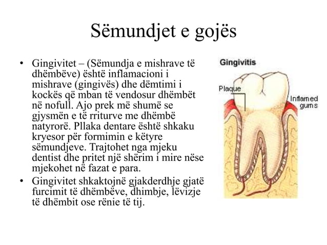 Higjiena e Gojes | PPTX