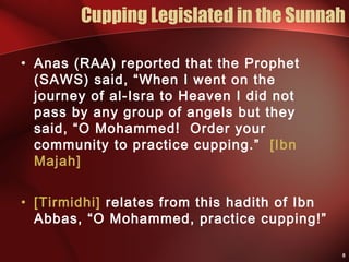 Hijama | PPT
