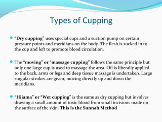 Hijamah(cupping therapy) | PPT | Islam | Religion & Spirituality