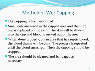 Hijamah(cupping therapy) | PPT | Islam | Religion & Spirituality