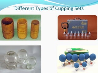 Hijamah(cupping therapy) | PPT | Islam | Religion & Spirituality