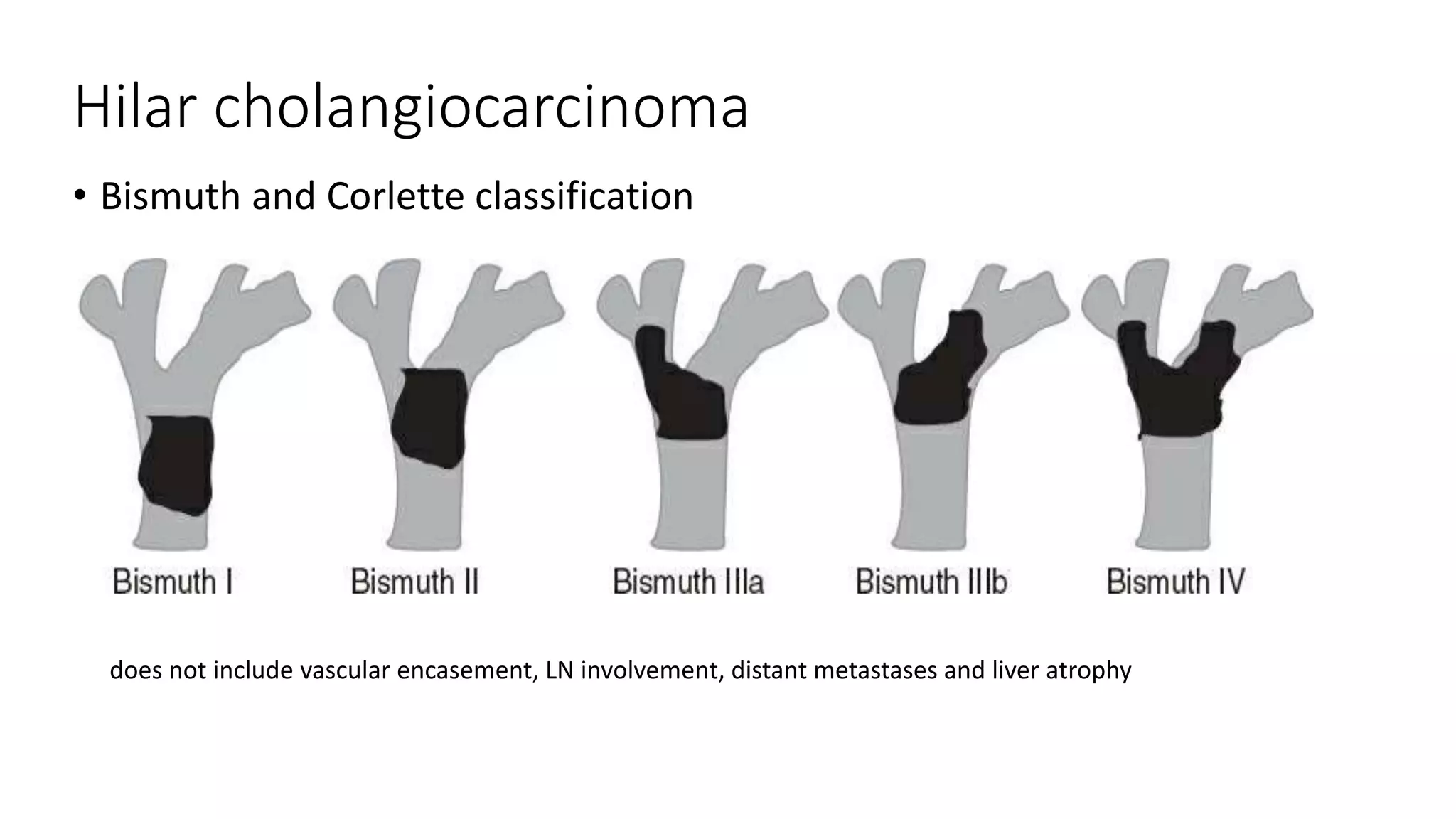 CHOLANGIOCARCINOMA | PPTX
