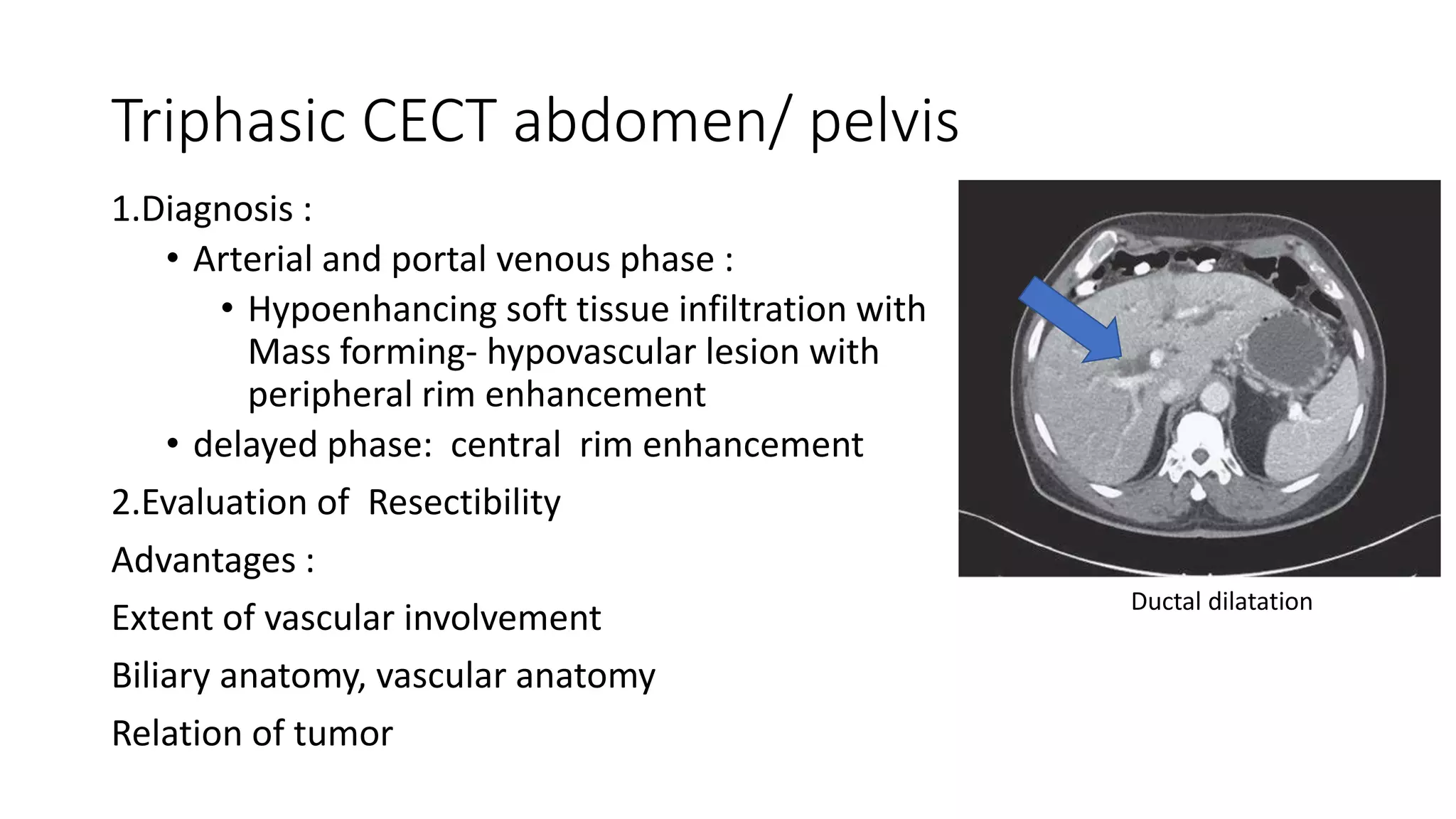CHOLANGIOCARCINOMA | PPTX