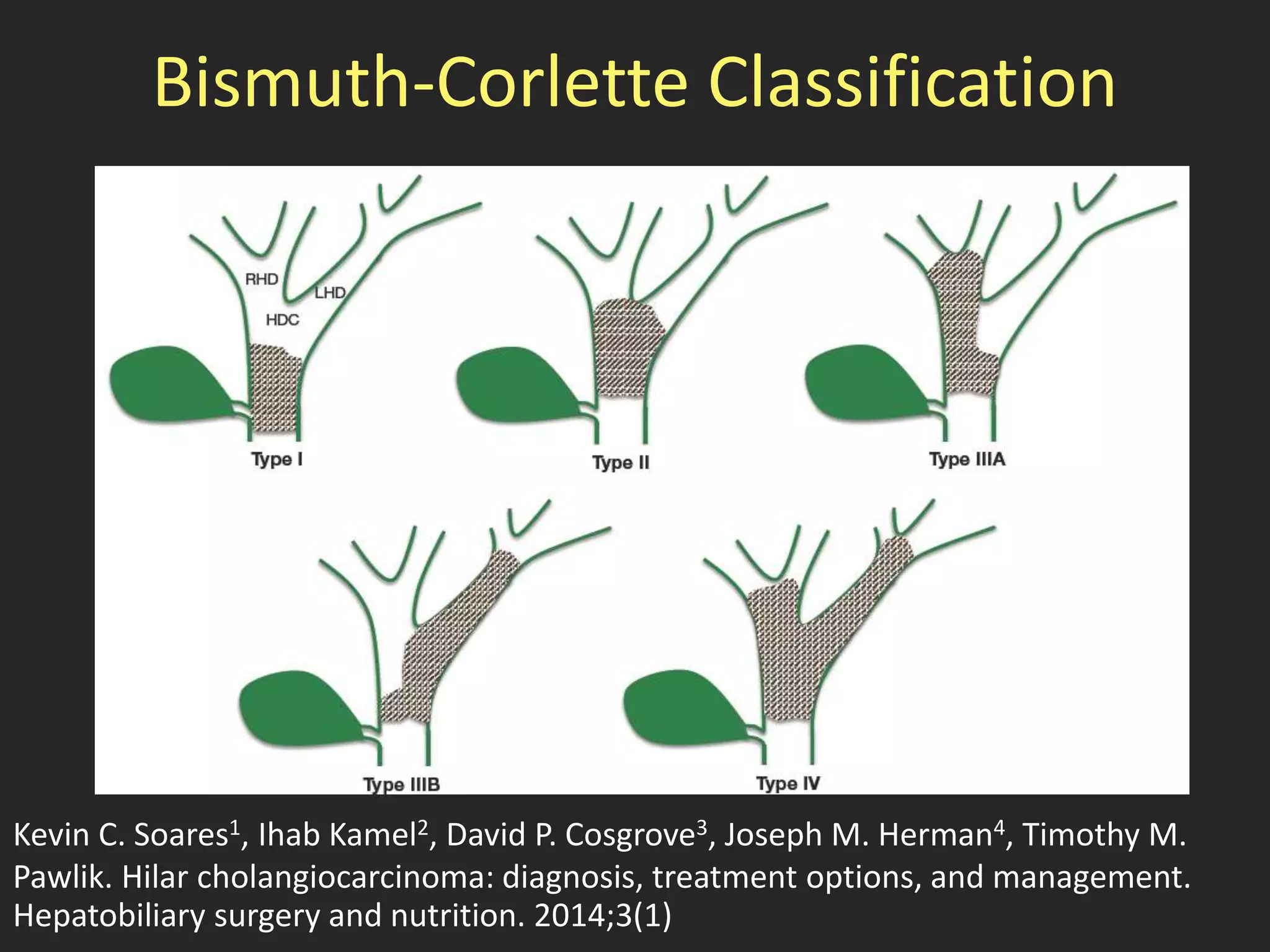 Hilar cholangiocarcinoma in my point of view | PPTX