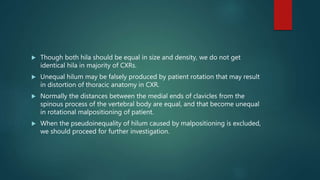 Hilar enlargement radiology | PPTX