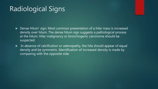 Hilar enlargement radiology | PPTX