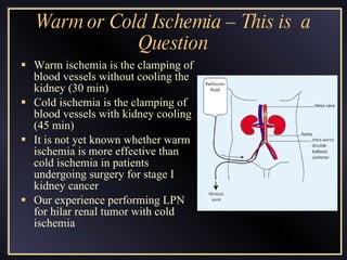 Laparoscopic Partial Nephrectomy of Hilar Tumors with Cold Ischemia | PPT