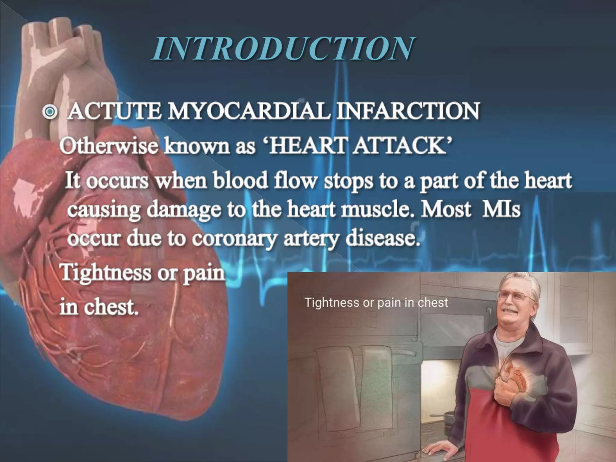 Myocardial infarction by Himaja.donthula | PPT