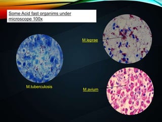 himalay baruah acid fast staining.pptx