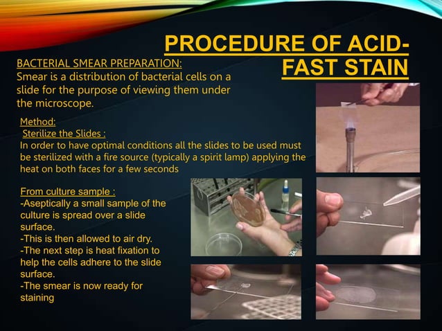 himalay baruah acid fast staining.pptx