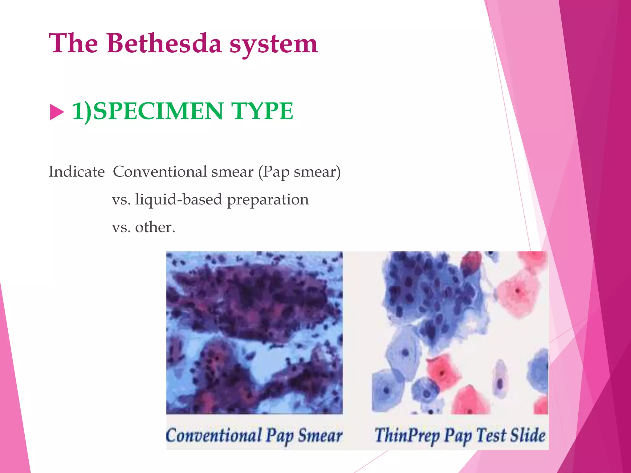 Bethesda system for cervix cytology | PPTX
