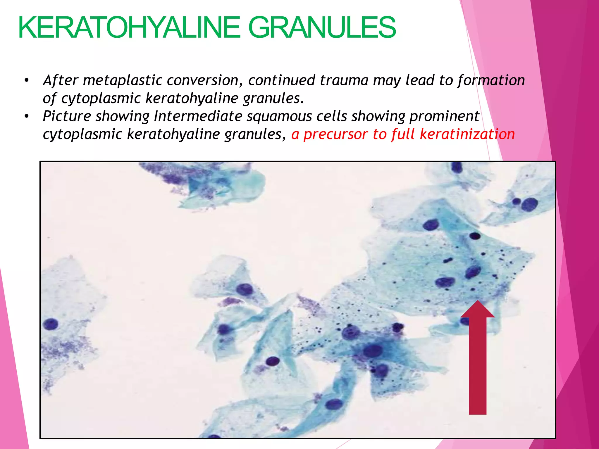 Bethesda system for cervix cytology | PPTX