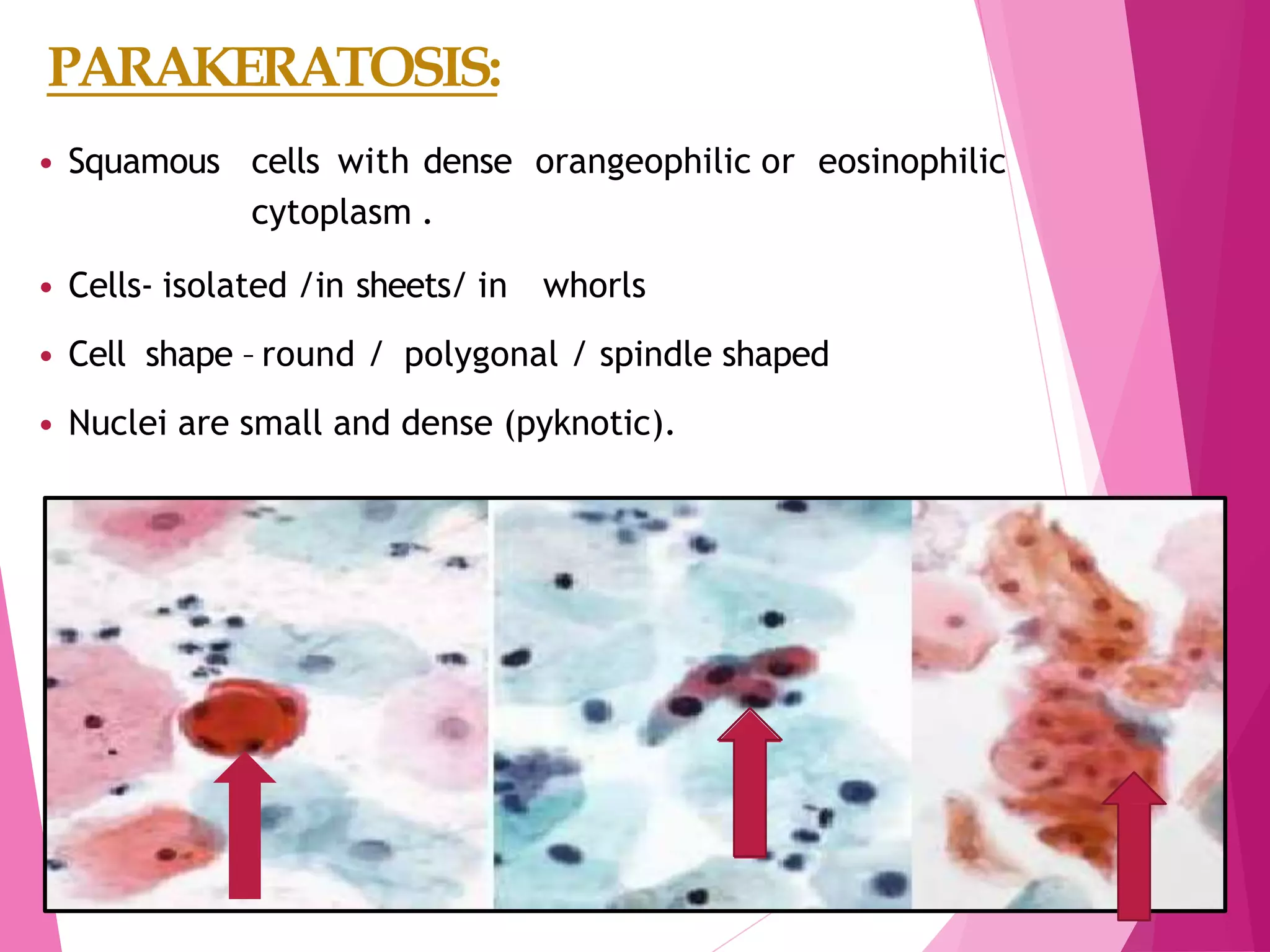 Bethesda system for cervix cytology | PPTX