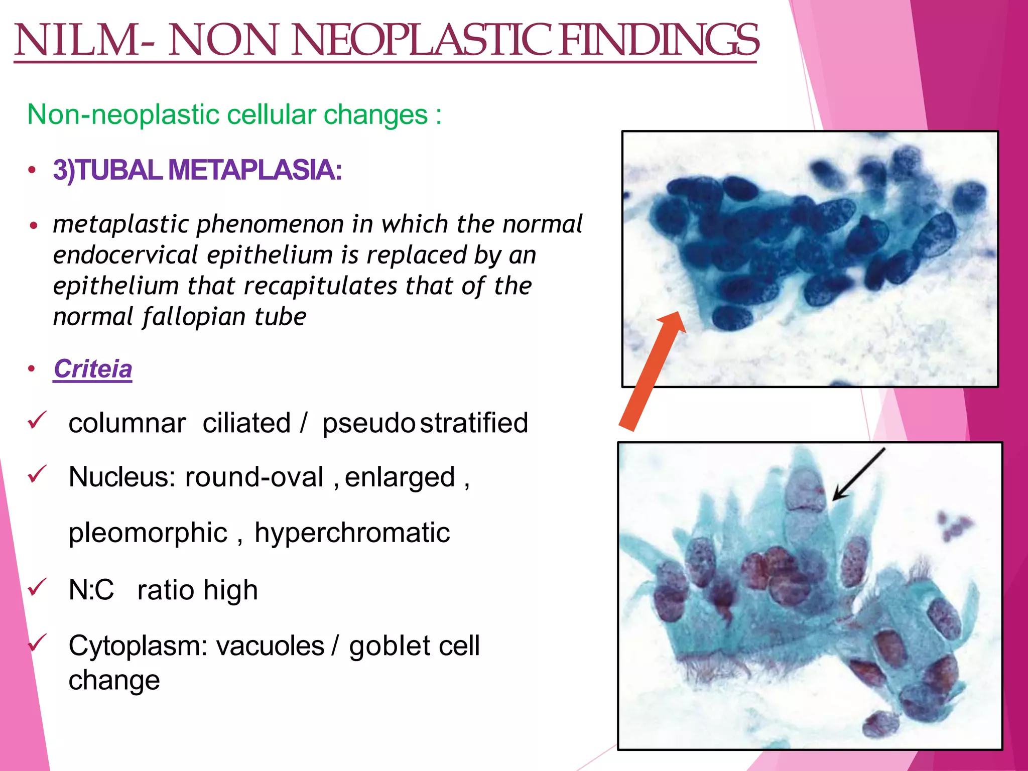 Bethesda system for cervix cytology | PPTX