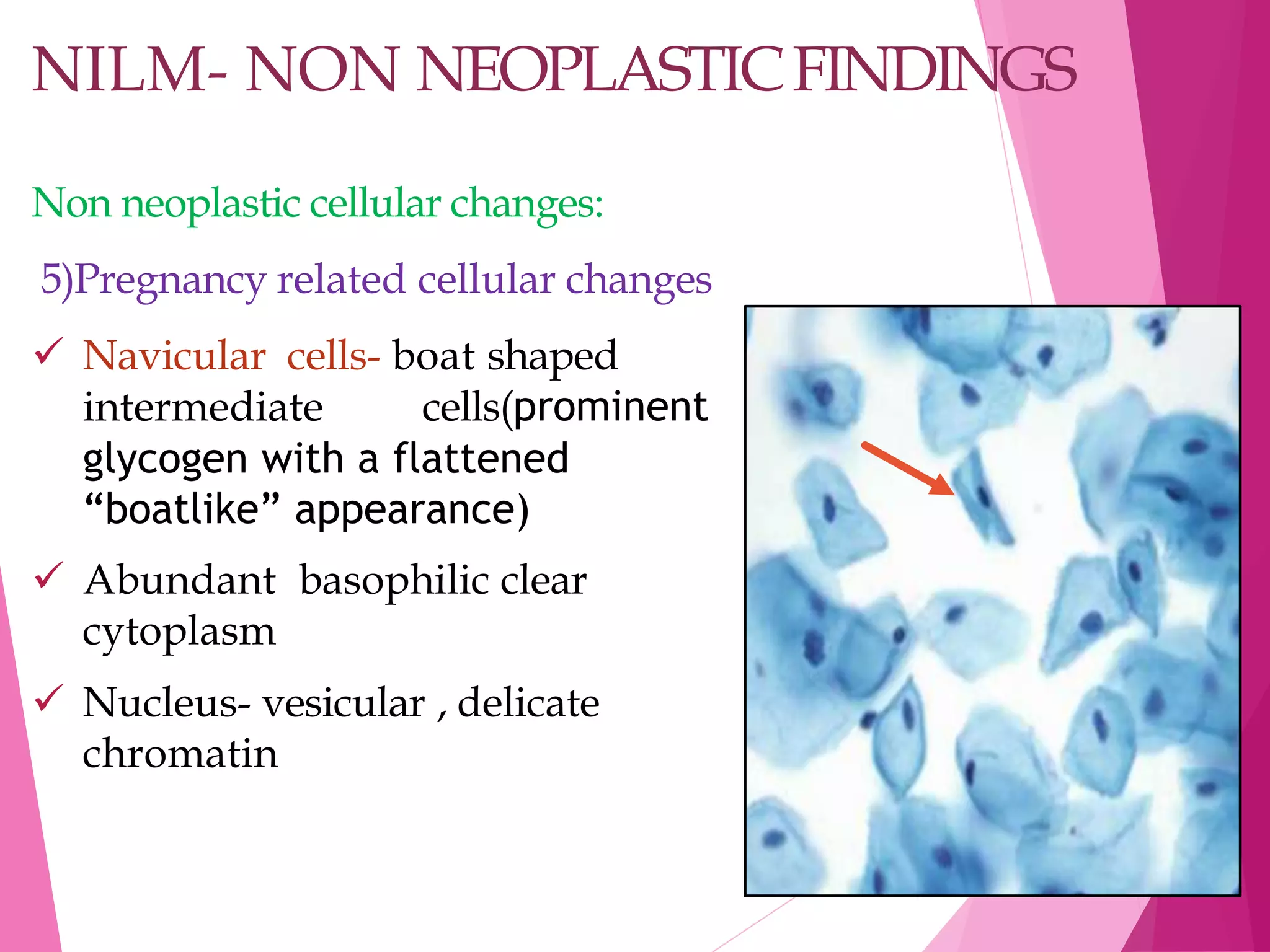 Bethesda system for cervix cytology | PPTX