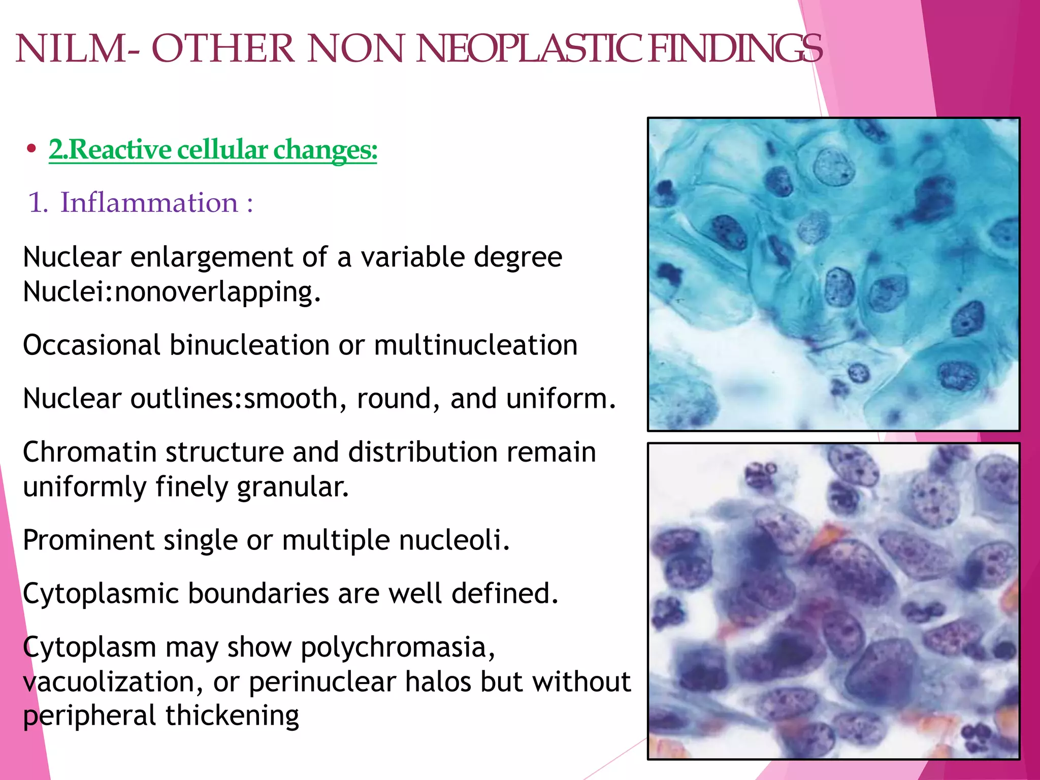 Bethesda system for cervix cytology | PPTX