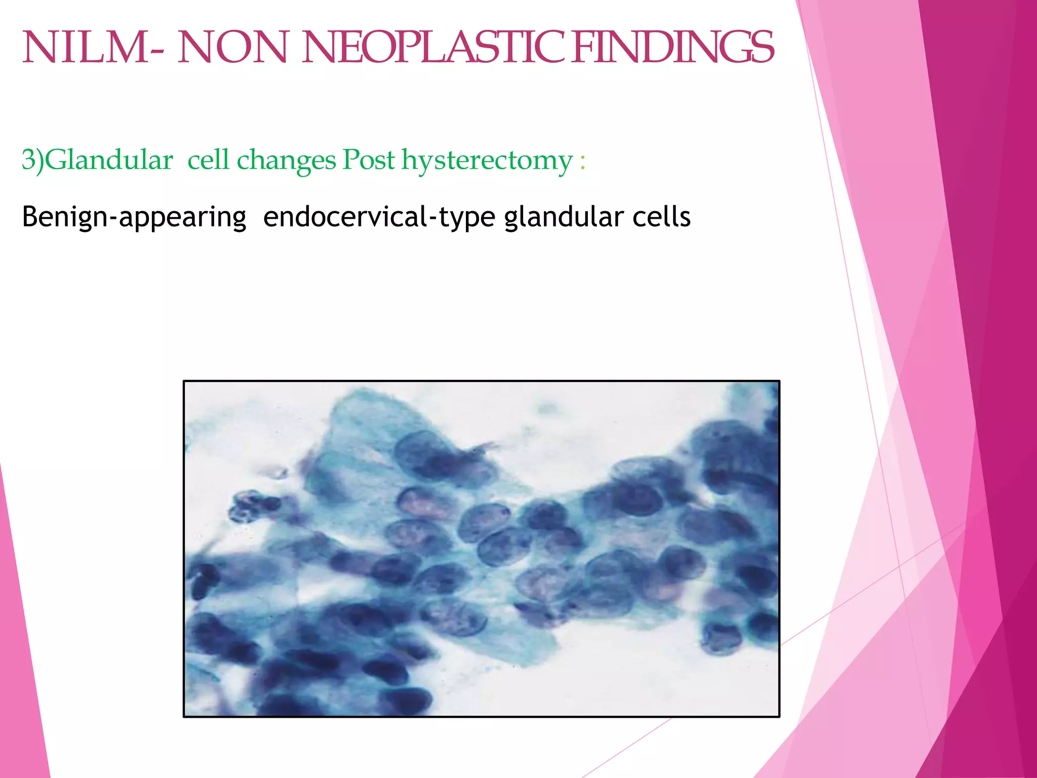 Bethesda system for cervix cytology | PPTX