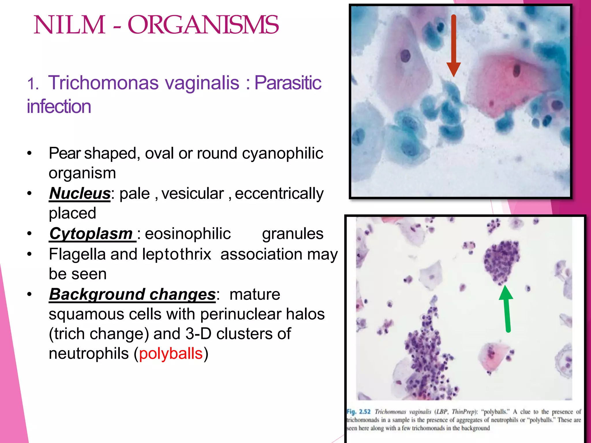 Bethesda system for cervix cytology | PPTX