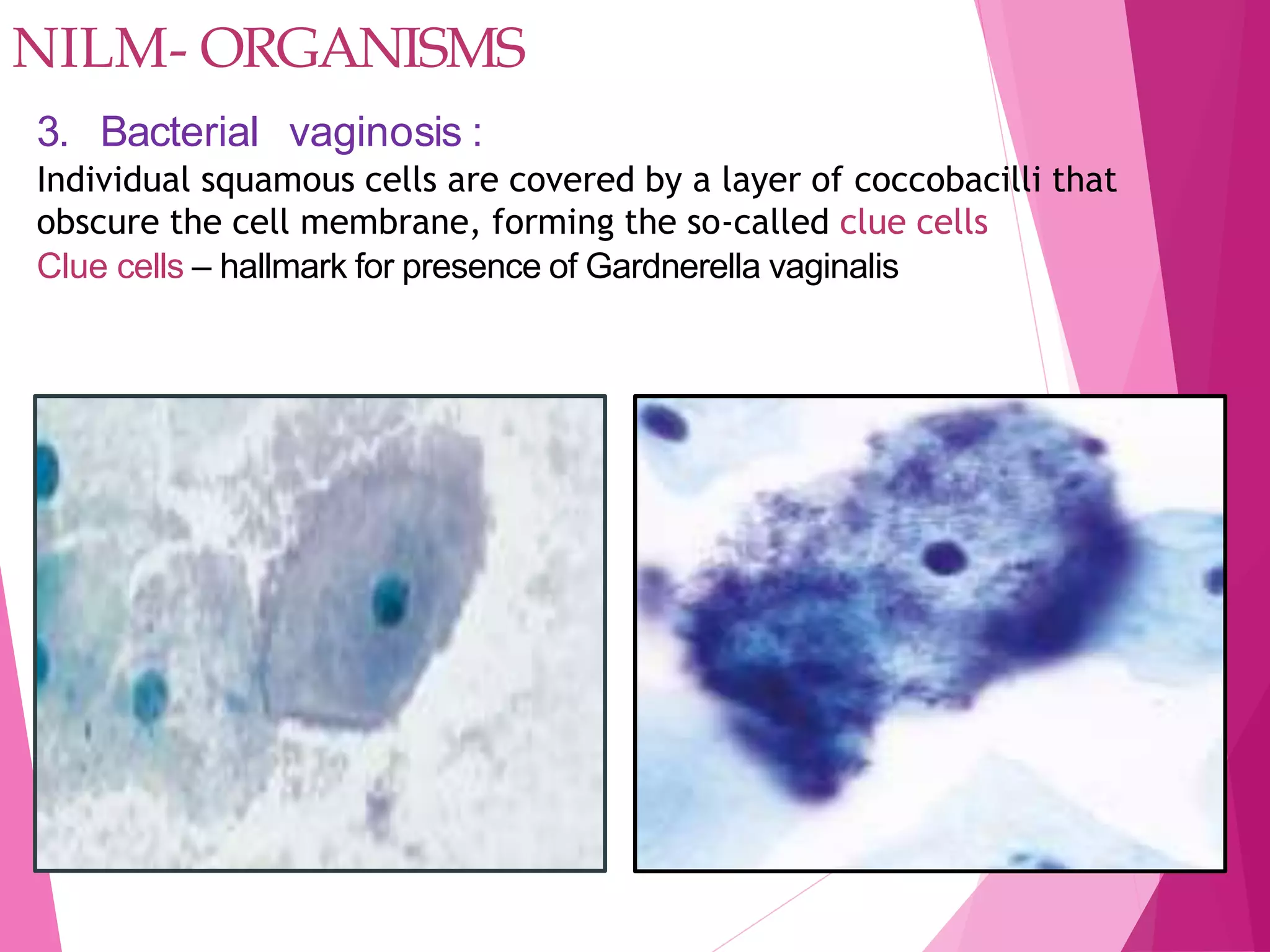 Bethesda system for cervix cytology | PPTX