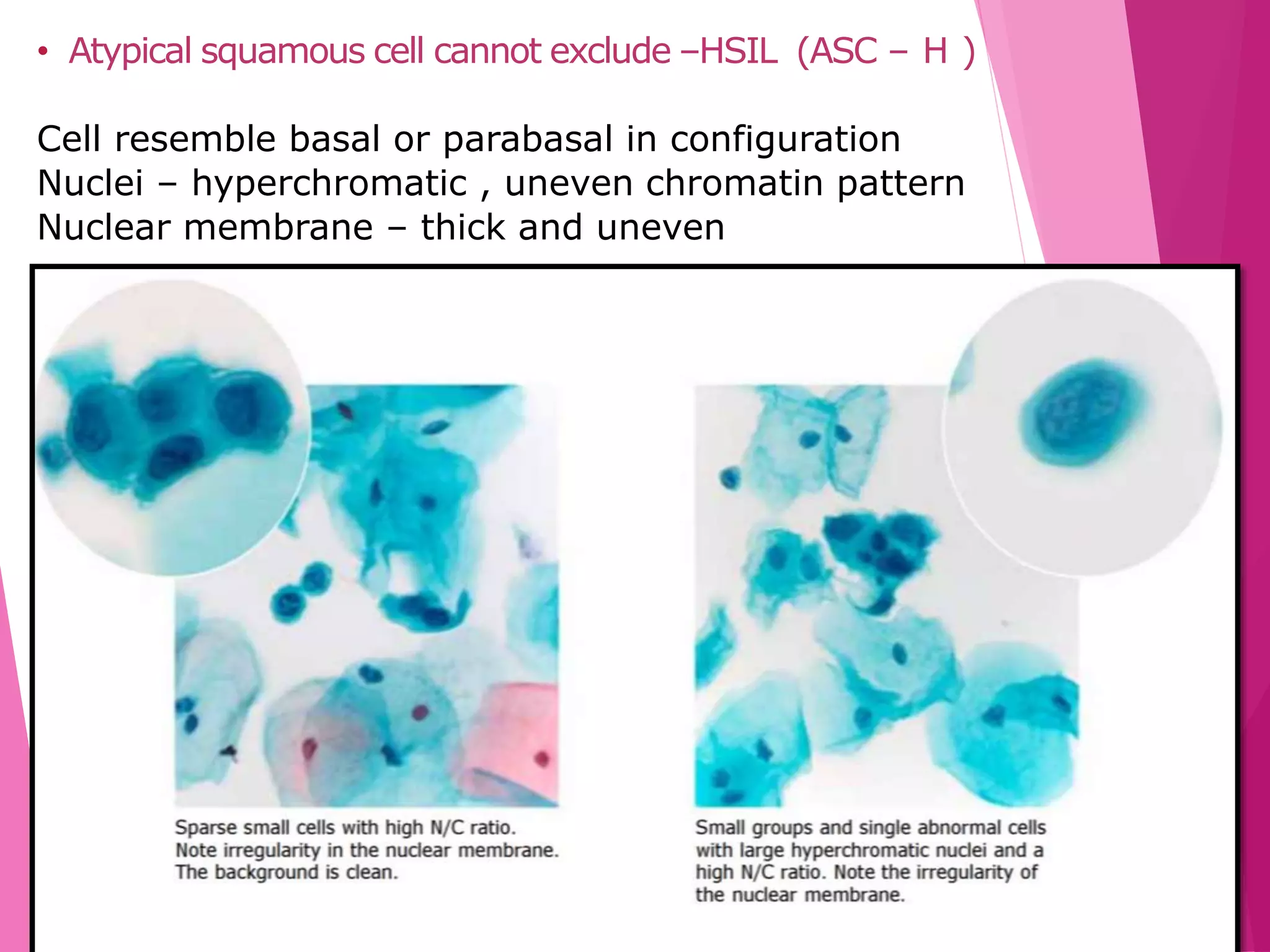 Bethesda system for cervix cytology | PPTX