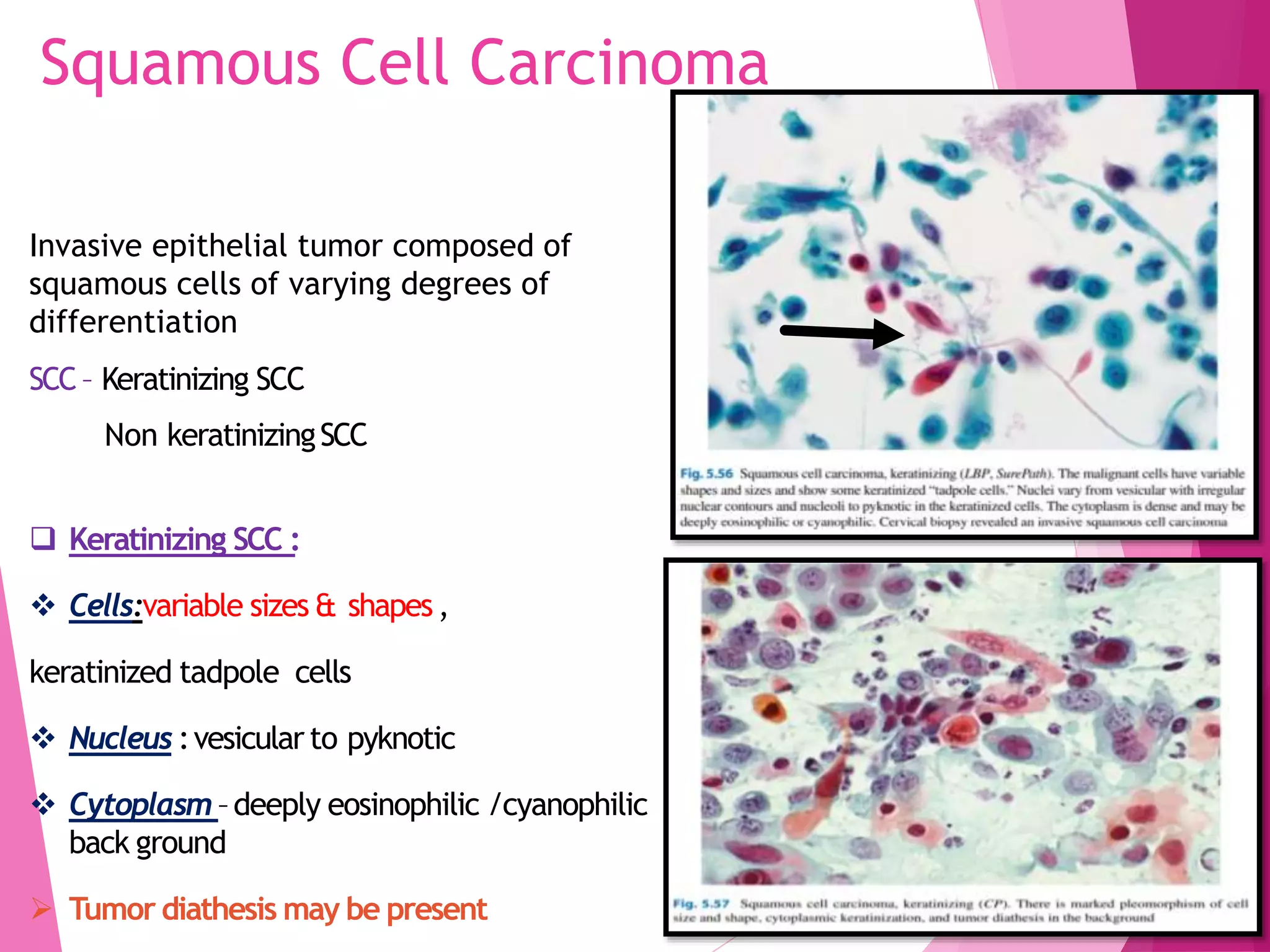 Bethesda system for cervix cytology | PPTX