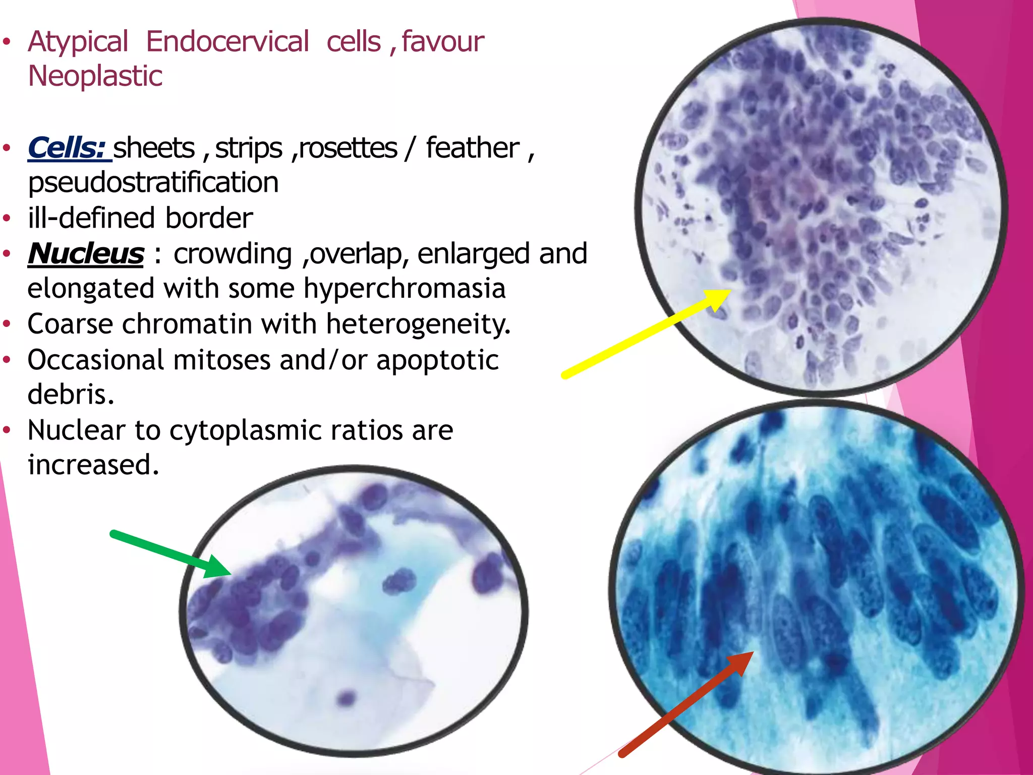 Bethesda system for cervix cytology | PPTX
