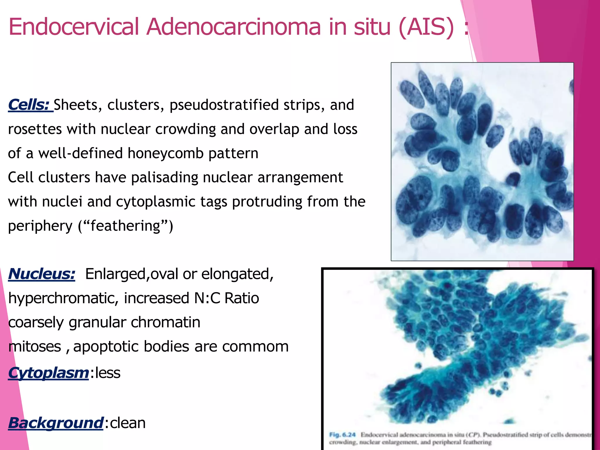 Bethesda system for cervix cytology | PPTX