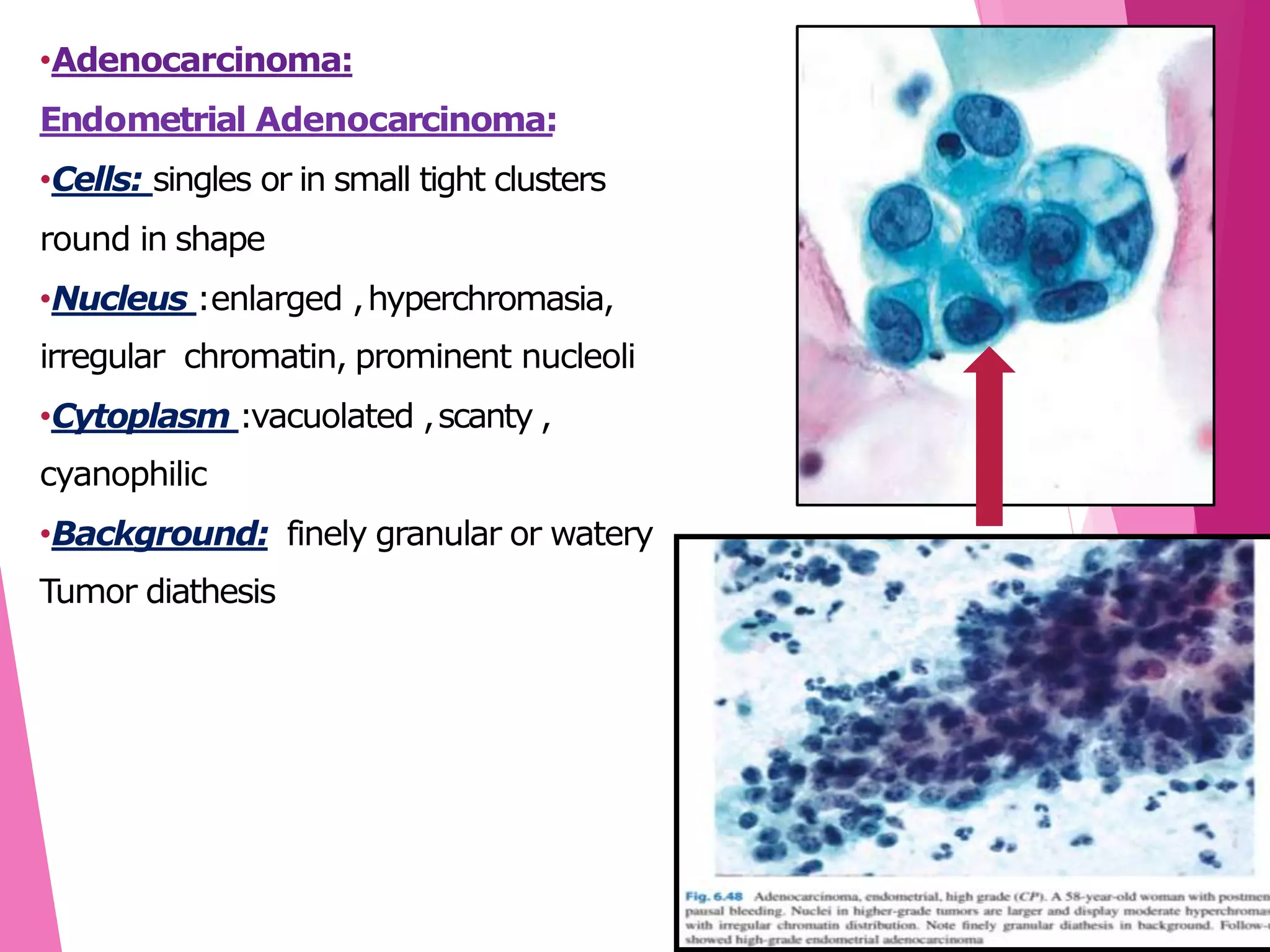 Bethesda system for cervix cytology | PPTX
