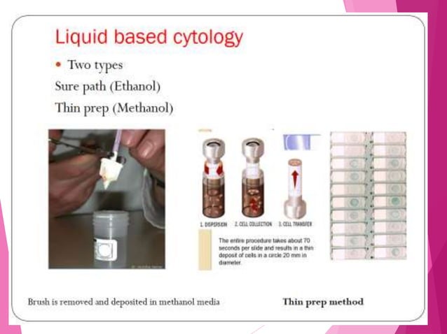 Bethesda system for cervix cytology | PPTX | Reproductive Health ...