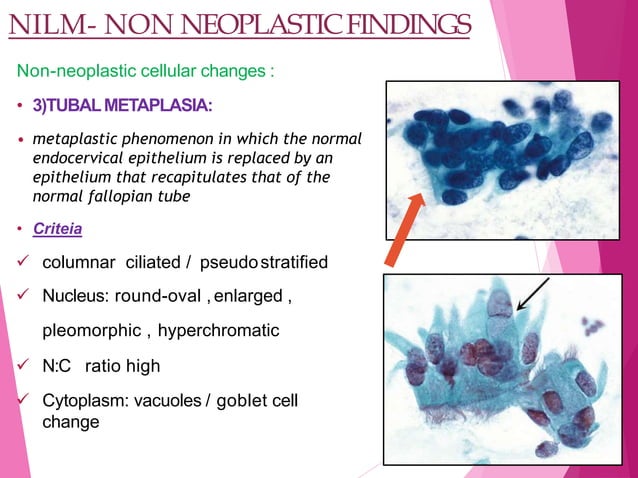 Bethesda system for cervix cytology | PPTX | Reproductive Health ...