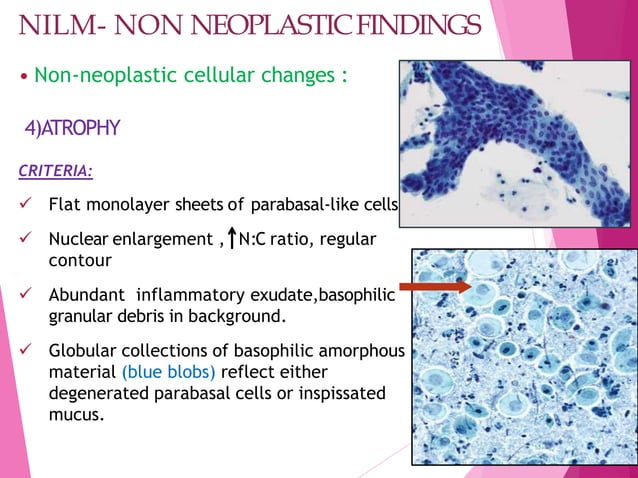 Bethesda system for cervix cytology | PPTX | Reproductive Health ...