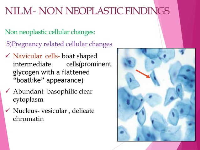 Bethesda system for cervix cytology | PPTX | Reproductive Health ...