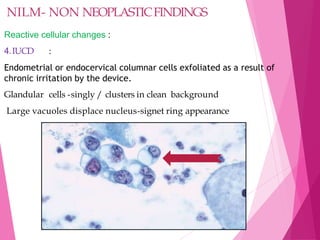 Bethesda system for cervix cytology | PPTX
