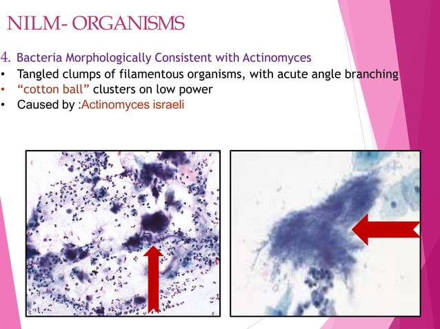 Bethesda system for cervix cytology | PPTX | Reproductive Health ...