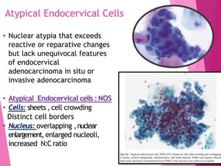 Bethesda system for cervix cytology | PPTX