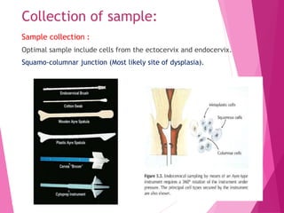 Bethesda system for cervix cytology | PPTX