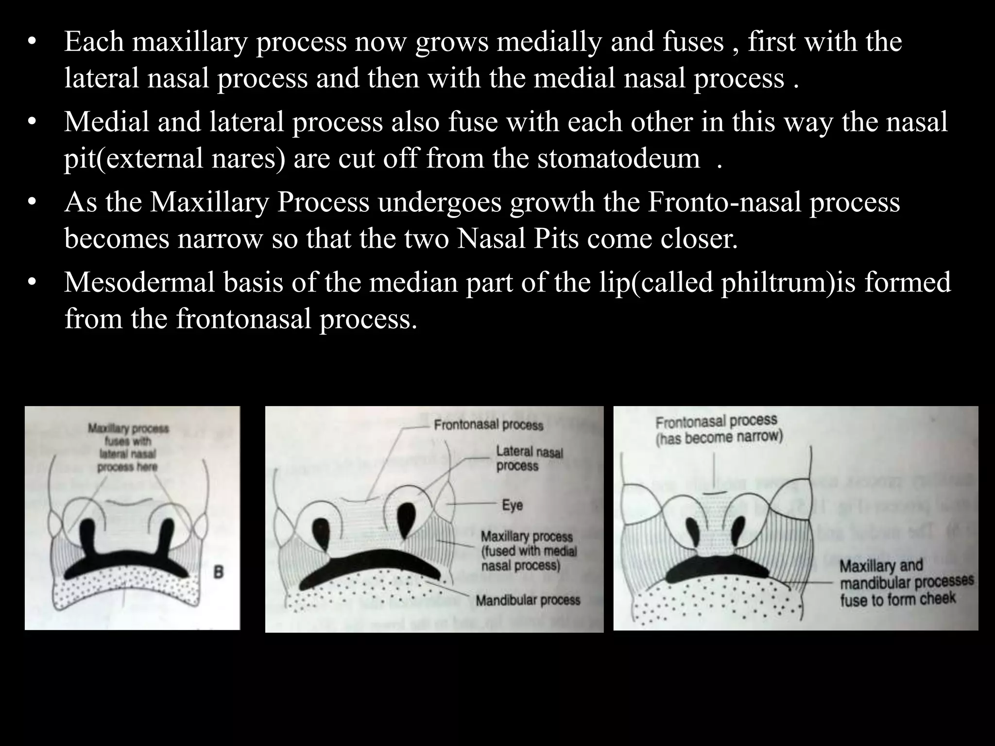 Prenatal and postnatal growth & development of maxilla and palate ...