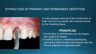 Tooth Extraction .pptx