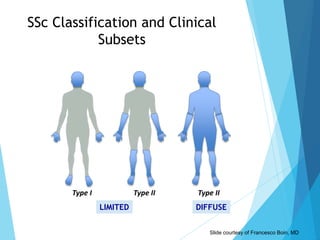 Systemic Sclerosis Skin Disease Research | PPTX | Skin and Dermatology ...