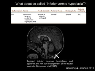 Posterior Fossa Malformations Dr Felice D'Arco | PPTX