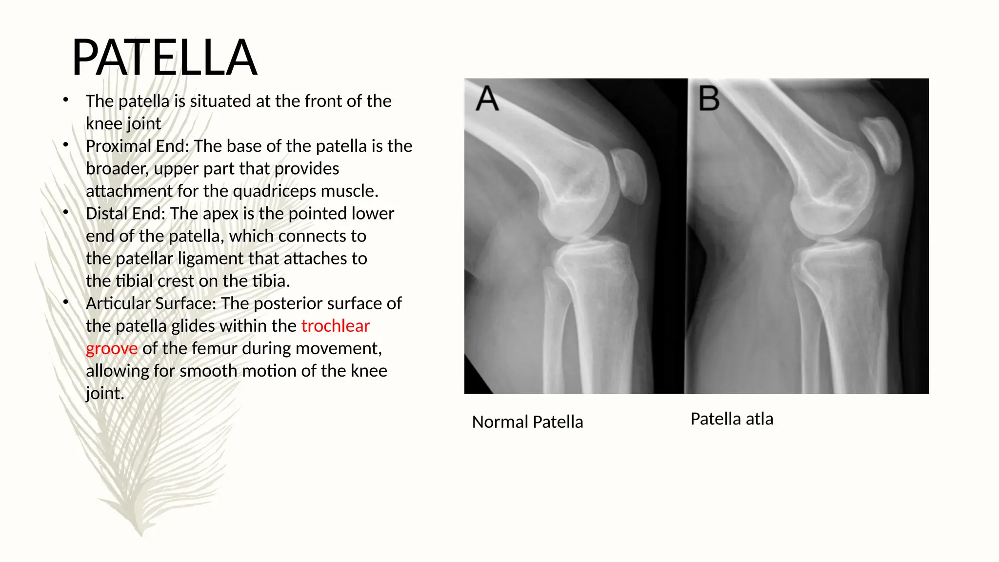Radiology anatomy of hindlimb of Dog and affections | PPTX