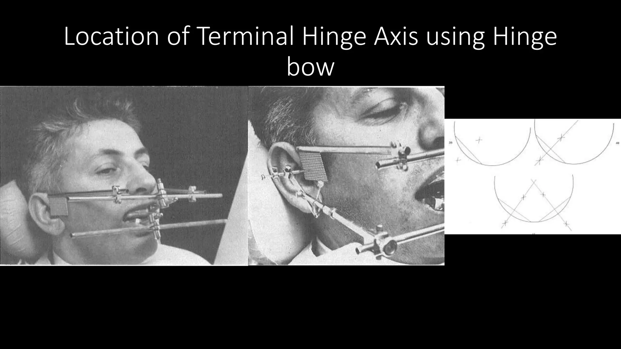 Hinge Axis | PPTX