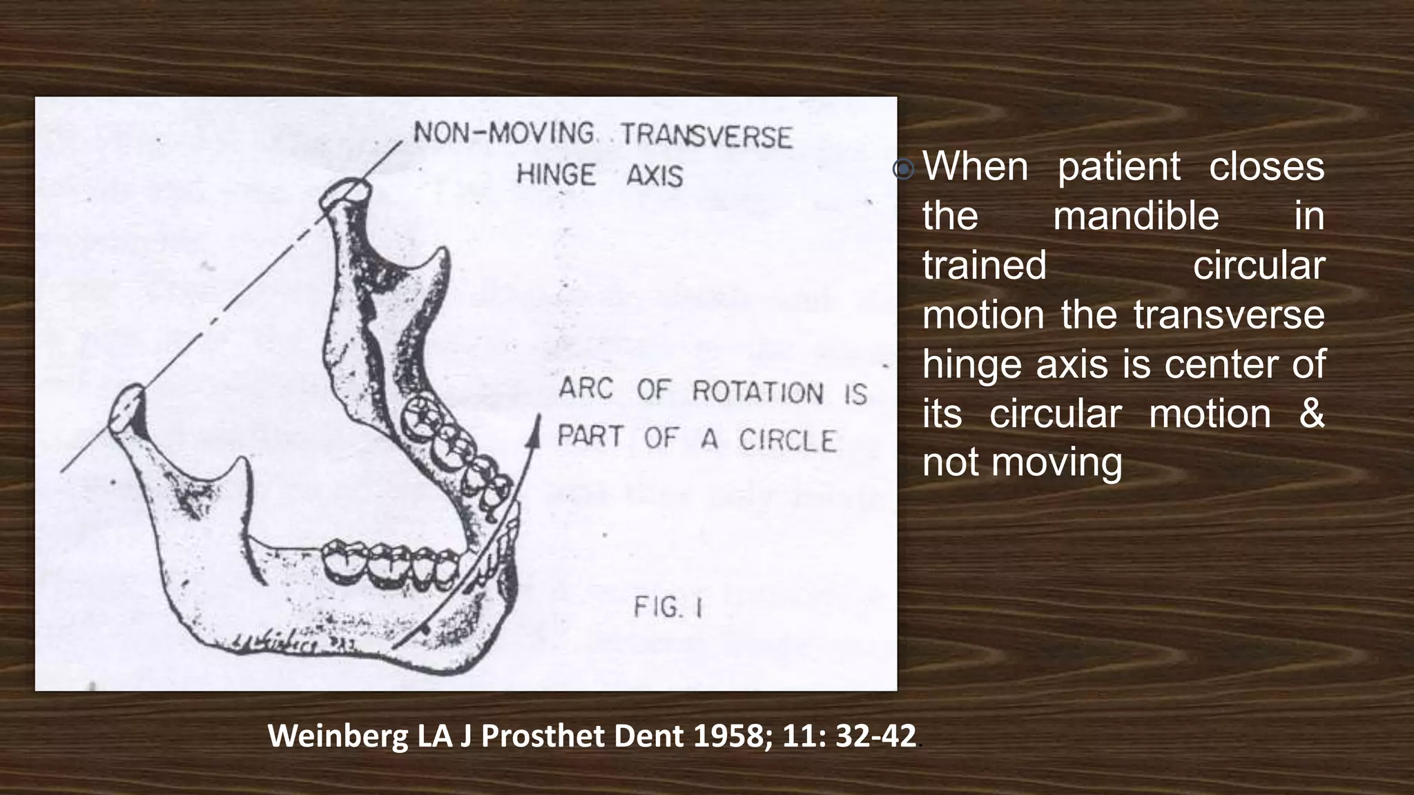 HINGE AXIS.pptx